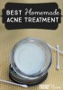 The Best DIY Acne Treatment – Bath and Body